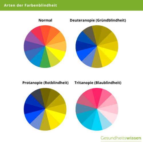 Diagnose Farbenblindheit: Symptome & Behandlung