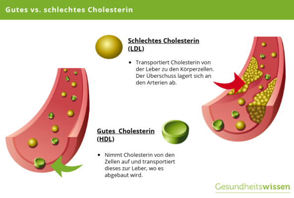 Cholesterin: So senken Sie Ihren Cholesterinspiegel | Tipps & Blutwerte