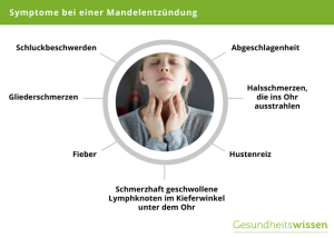 Mandelentzündung - Ursachen, Symptome & Behandlung