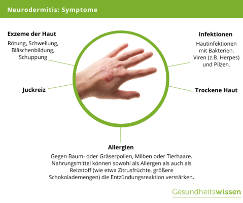 Diagnose Neurodermitis: Ursachen, Symptome & Behandlung