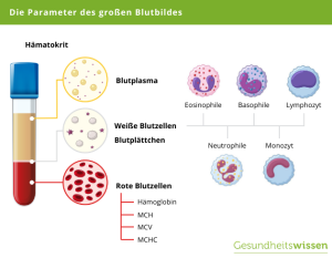Gro 223 Es Blutbild Die Wichtigsten Werte Erkl 228 Rt 2022
