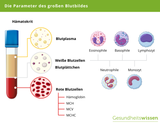 Großes Blutbild – Die wichtigsten Werte erklärt